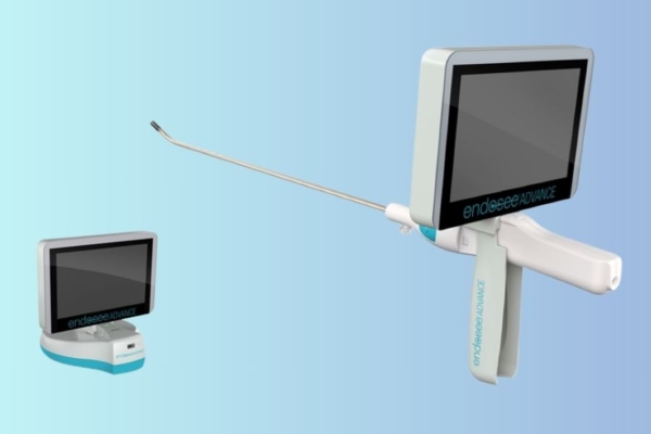 From Setup to Diagnosis: The Simplicity and Efficiency of Endosee ...